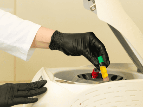 PRP for Shoulder Injuries and Tennis Elbow: A Non-Surgical Alternative ...